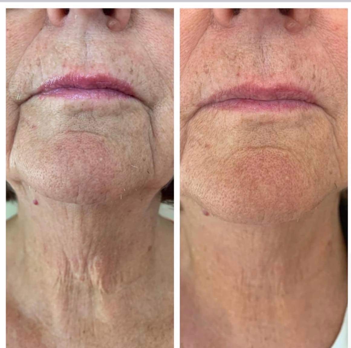 Activated Collagen – Earth Body Connection by Dessiree