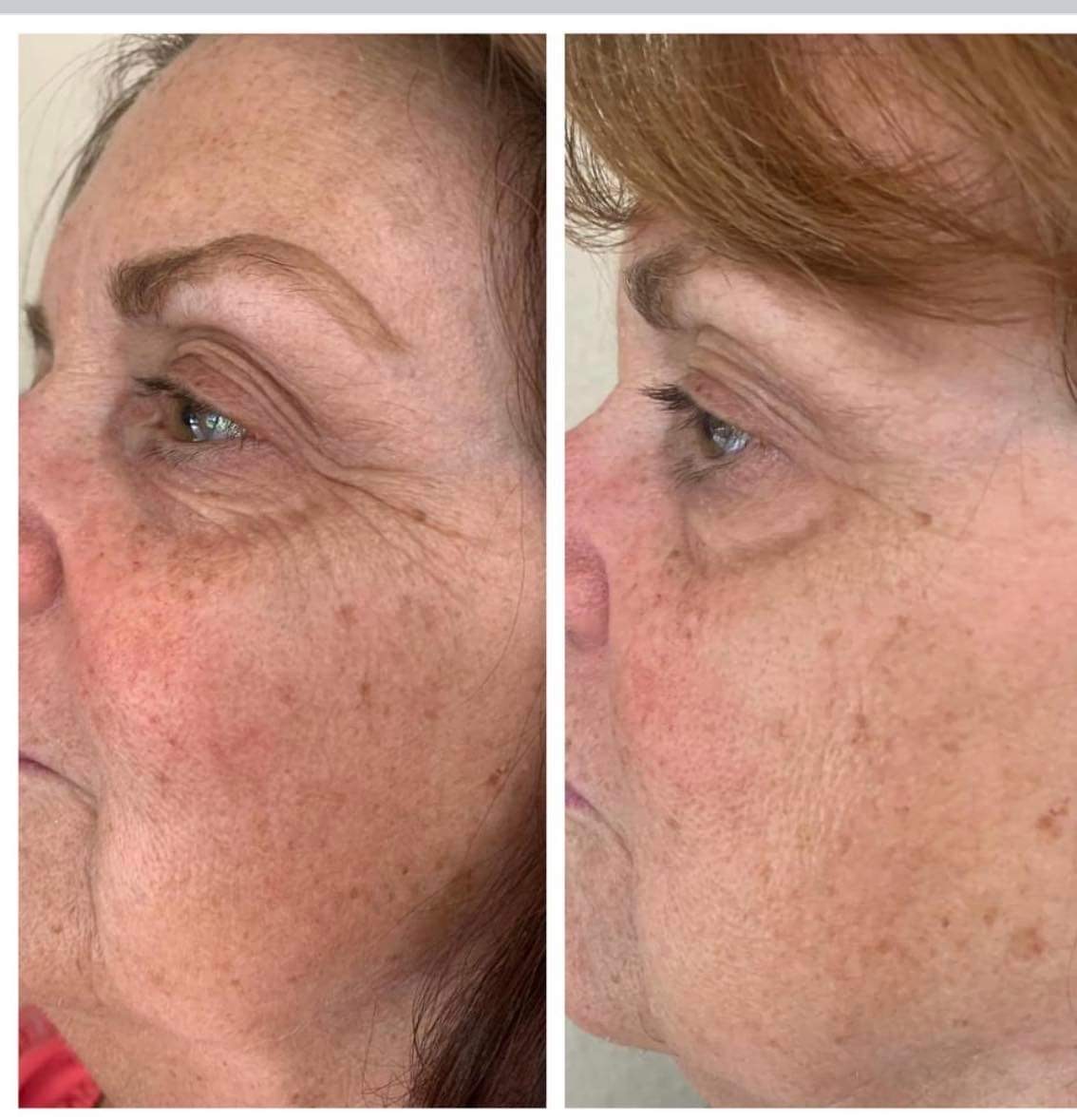 Activated Collagen – Earth Body Connection by Dessiree