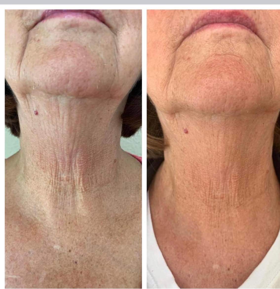 Activated Collagen – Earth Body Connection by Dessiree