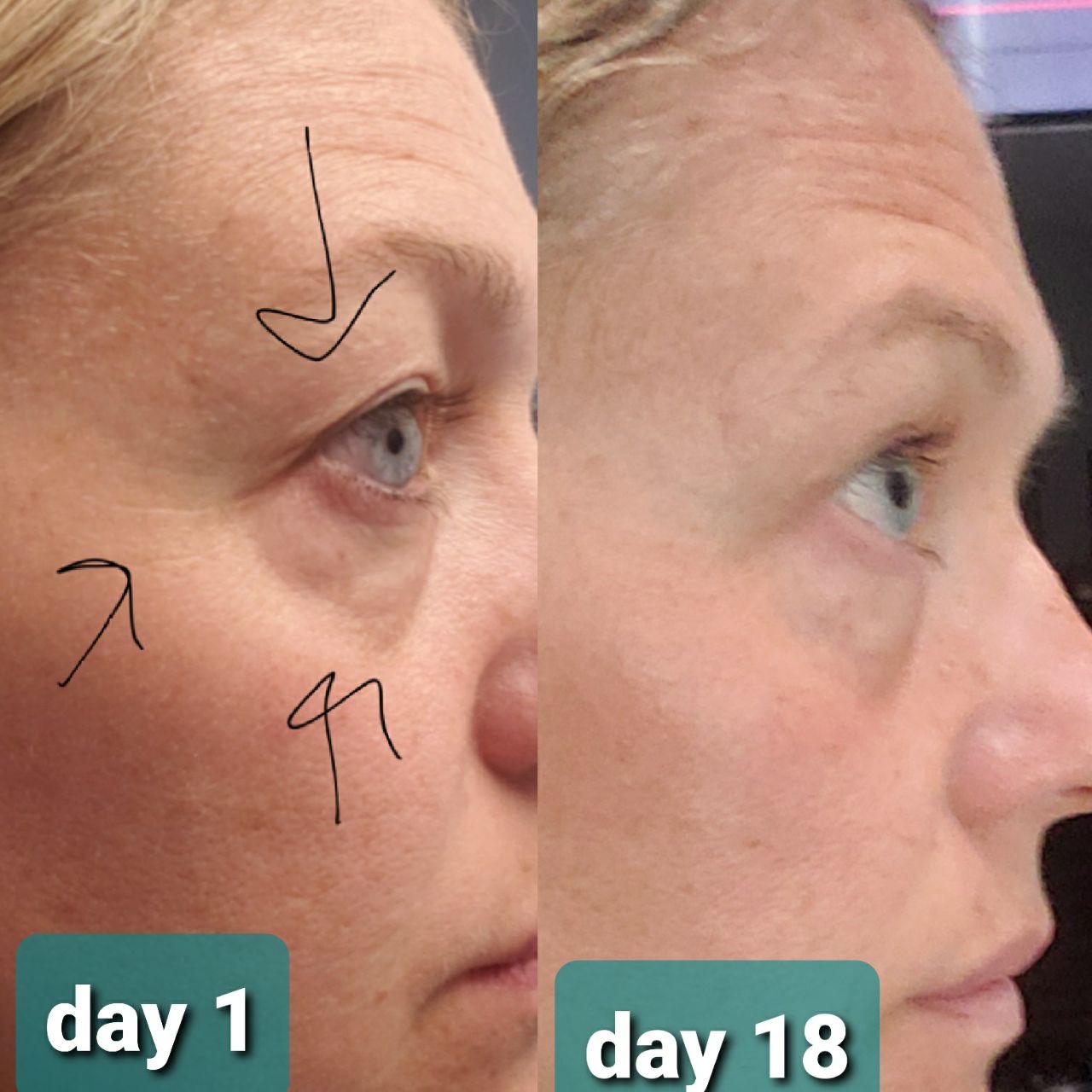 Activated Collagen – Earth Body Connection by Dessiree