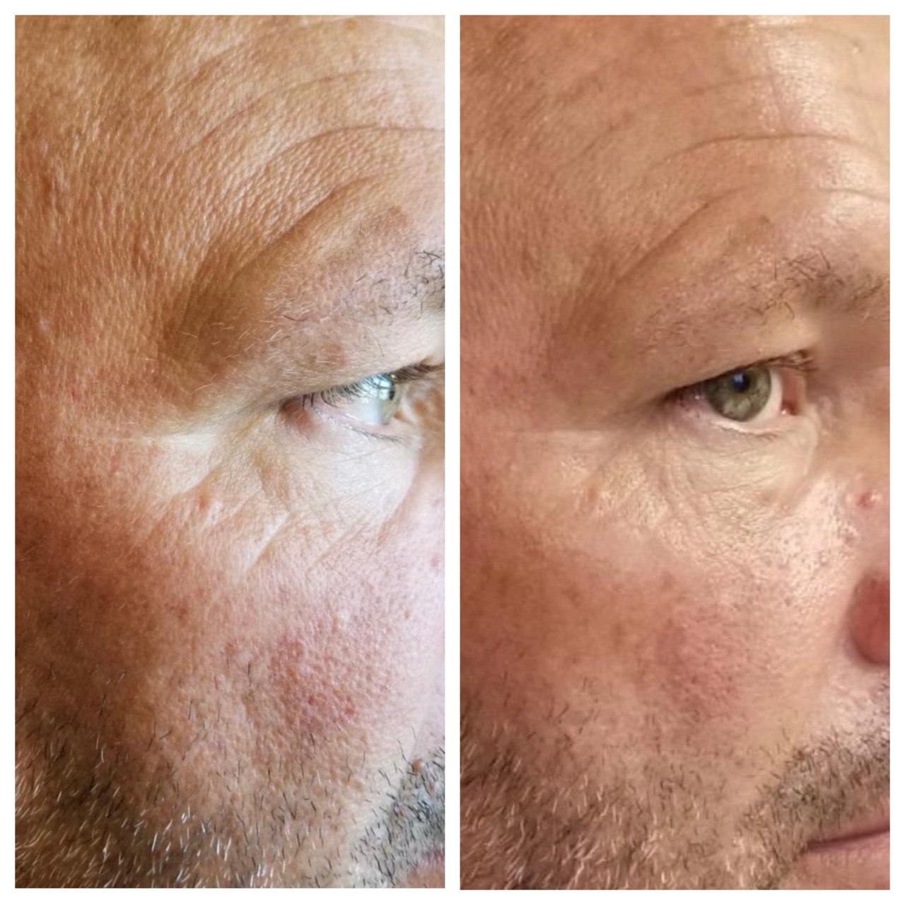 Activated Collagen – Earth Body Connection by Dessiree